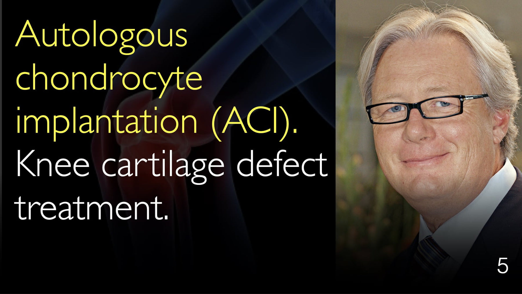 Autologous chondrocyte implantation (ACI). Knee cartilage defect treat ...